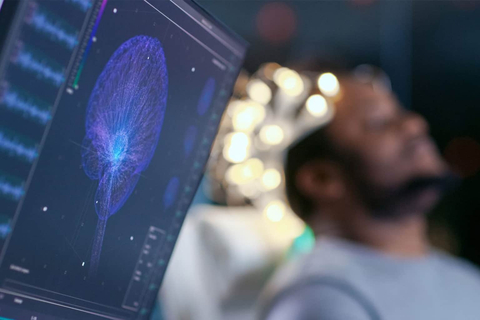 Neurofeedback therapy and Brain Training - The Insight Clinic