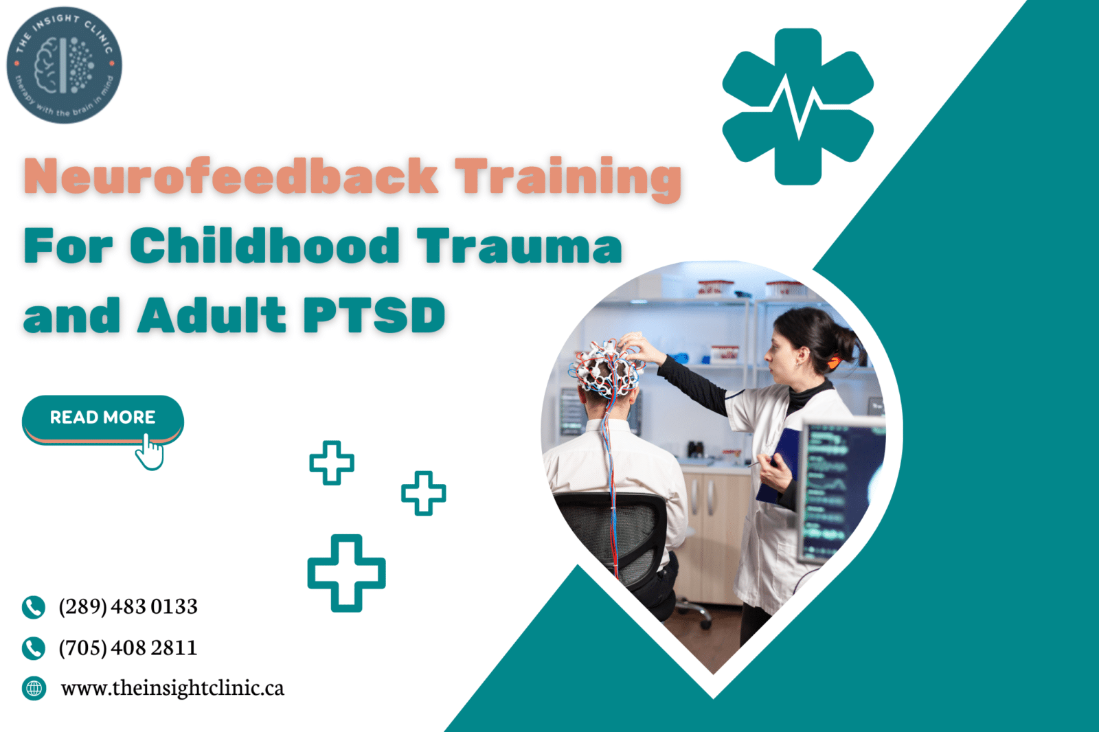 The Role of Neurofeedback Training in Treating Covert Childhood Trauma ...